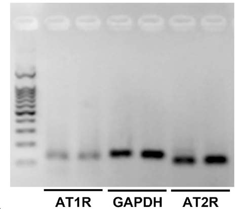 Expression Of At1r And At2r Mrna In Human Bone Marrow Mscs