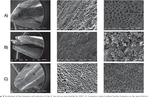 Figure 5 From Evaluation Of In Vitro Biofilm Elimination Of Enterococcus Faecalis Using A