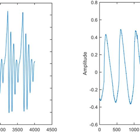 Three Types Of Signal Examples From The Meei Database 15 Download Three Types Of Signal Examples From The Meei Database 15 Download