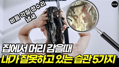 탈모 부르는 잘못된 머리감기 습관 머리감는방법 내가 잘못 하고 있는 행동 5가지 올바른 샴푸 방법 비듬지성두피떡짐 Youtube