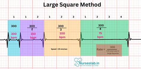 Calculating Heart Rate On An Ecg Explained Nurseslab