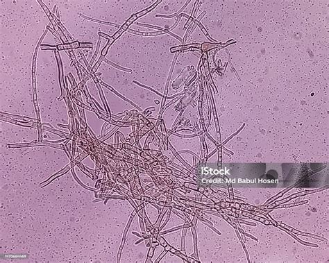 Hongos Microscópicos Malassezia Furfur Mostrando Células De Levadura E