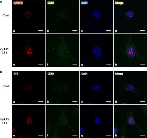Expression Of C Ebpβ A And Yy1 B In Ge1 Gingival Epithelial Cells Download Scientific