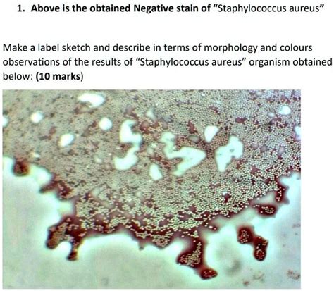 Above Is The Obtained Negative Stain Of Staphylococcus Aureus Make A Label Sketch And Describe