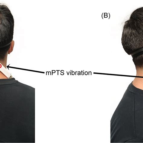 A Vibrator Placement On Sternocleidomastoid Muscle In The Center Of Download Scientific
