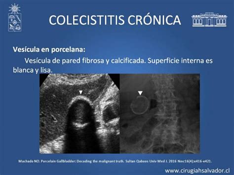 Presentaciones Depto Cirugía Hospital Del Salvador