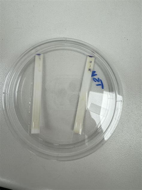 Oxidase Test Results Help Rmicrobiology