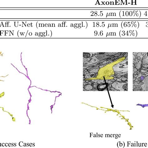 Axon Segmentation Results On Axonem Dataset Erl Download