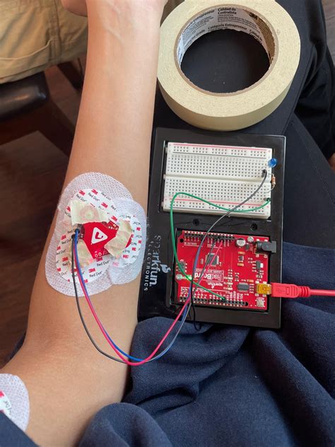 Myoware Sensor Not Outputting Correct Data R Myoware