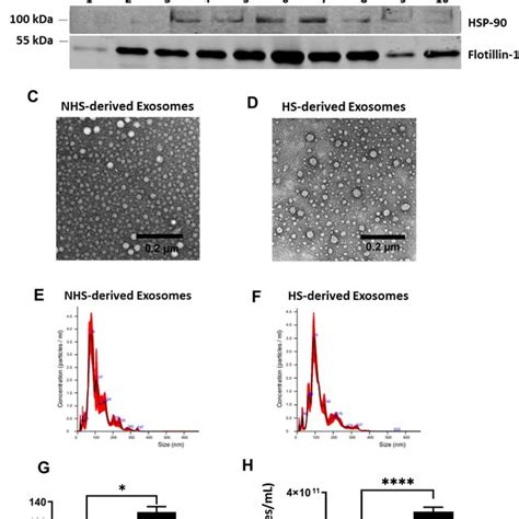 Hs Derived Evsexosomes Exhibit Increased Diameter And Concentration