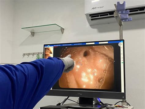 Endogastro Estenosis Pilorica Péptica
