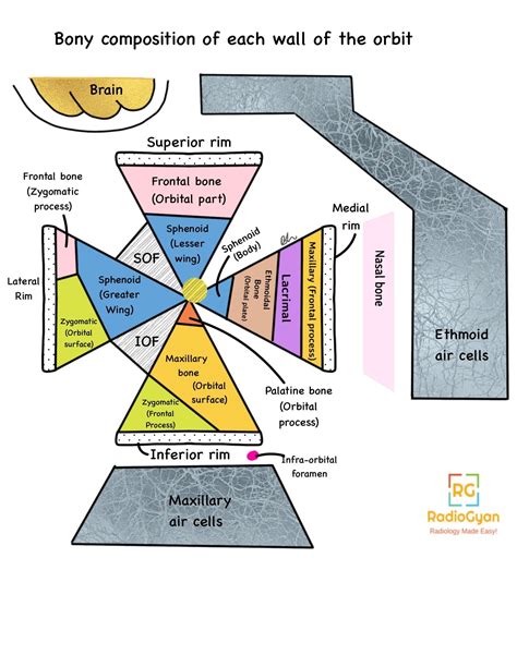 Blow Out Fracture Of The Orbit Radiology Case Radiogyan