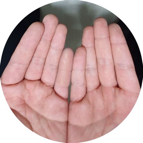 새끼손가락 실리콘 손가락 의수 착용 후기의수 가격 네이버 블로그