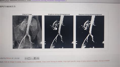 Matlab For Image Processing Gray Level Slicing Rmatlab