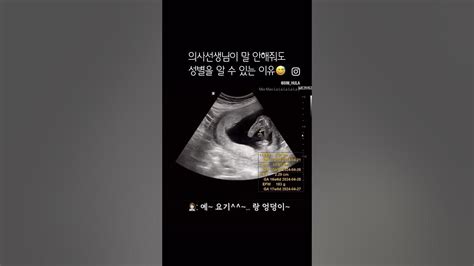 16주 아들 초음파 Feat 🌶️ Shorts Youtube