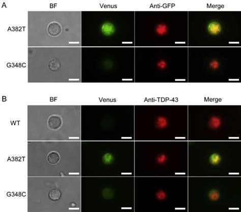 Individual Visualization Of Mutant And Normal Tdp 43 Localization In