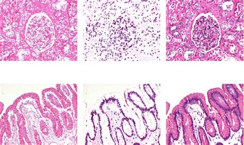 Segmenting Microscopic Images