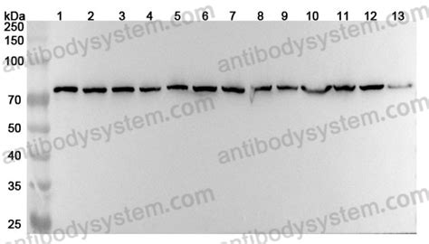 Buy Anti Hspa8 Polyclonal Antibody