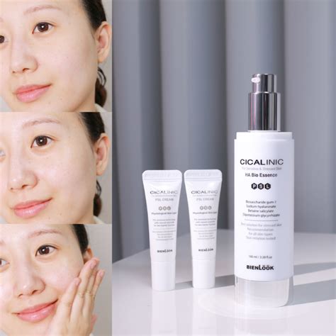 시카리닉 피부 속당김에센스 건성 수부지 피부 모여라 네이버 블로그