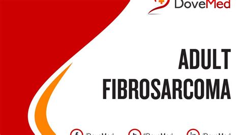 How Well Do You Know Adult Fibrosarcoma