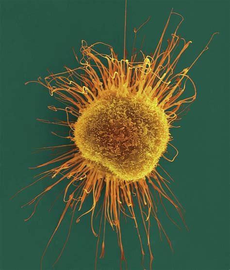 Human Dendritic Cell Photograph By Dennis Kunkel Microscopy Science Photo Library