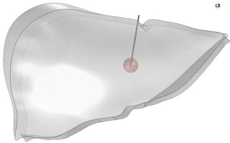 Schematic Of Simulating Hepatic Radiofrequency Ablation In 3 D Model Download Scientific