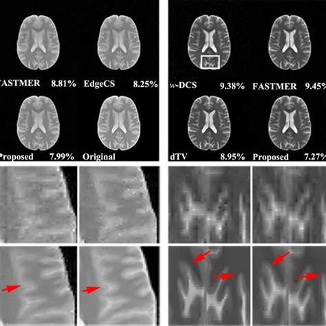 Two Types Of Subsampling Patterns Left 1d Variable Density Random Download Scientific Diagram