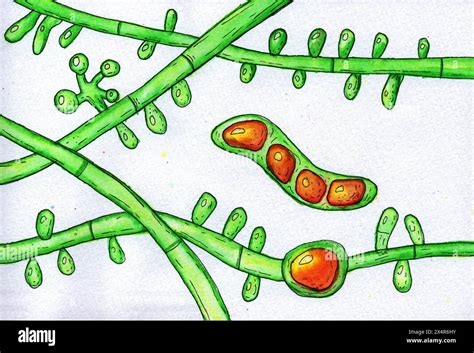 Illustration Of Trichophyton Tonsurans Fungi This Dermatophyte Fungus Causes Scalp Infections