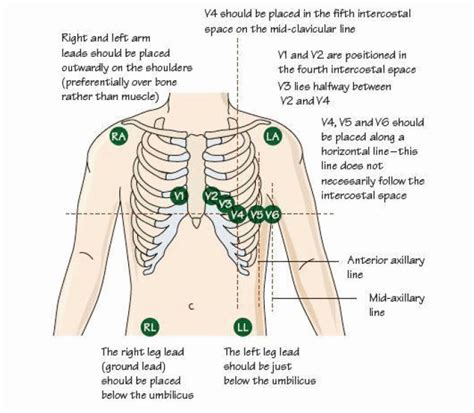 A Review Paper On Analysis Of Electrocardiograph Ecg Signal For The Detection Of Arrhythmia