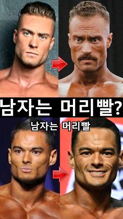 피해 갈 수 없는 탈모의 스트레스 Youtube