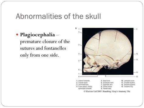 Ppt Functional Anatomy Of Skull Powerpoint Presentation Free Download Id 416189