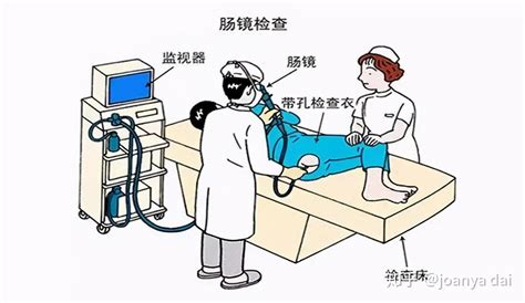 结直肠癌的结肠镜检查前需要清洁肠道？结肠镜检查需要注意哪些事 知乎