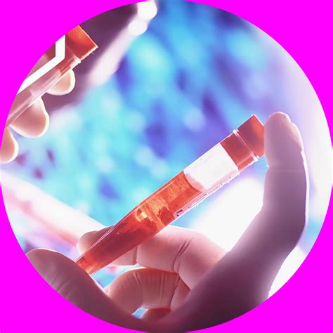 Lymphoprep Density Gradient Media