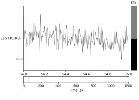 Figure 1 From Epilepsy Prediction Using A Combined Lstm Xgboost