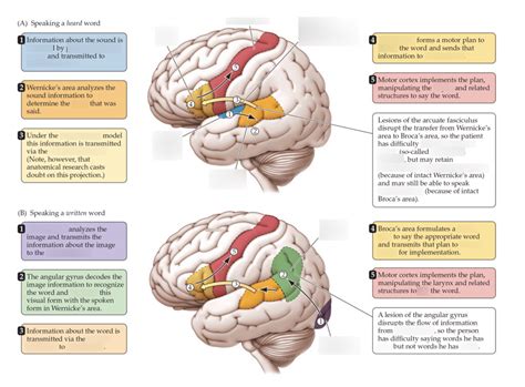 Conduction Model Of Aphasia Diagram Quizlet