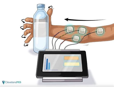 Neuromodulation Biomedicalengineer Neurostimulation Research Cleveland Fes Center
