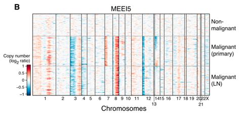 Patient Meei5 Scrnaseq Cnv Heatmap 生信菜鸟团