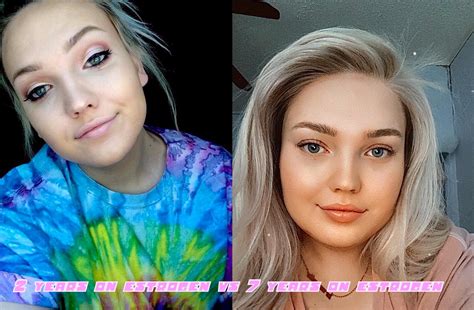 Sometimes Feel Like My Transition Has Been Stagnant Scrolller