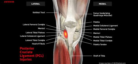 Knee Pcl Large