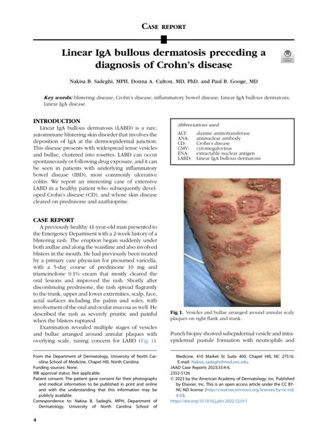 Pdf Linear Iga Bullous Dermatosis Preceding A Diagnosis Of Crohns