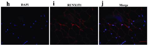 Expression Patterns Of Runx1t1 Isoforms In The Subcutaneous Fat The