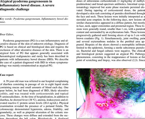 Atypical Pyoderma Gangrenosum Download Scientific Diagram