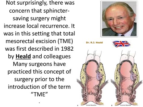 Transanal Total Mesorectal Excision Pptx Digestive Disorders Diseases And Conditions