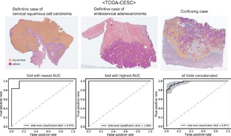 Figure 1 From Deep Learning Based Classification Of Uterine Cervical