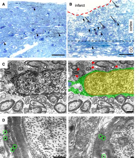 Figure 4 From Oligodendrocytes In Human Induced Pluripotent Stem Cell