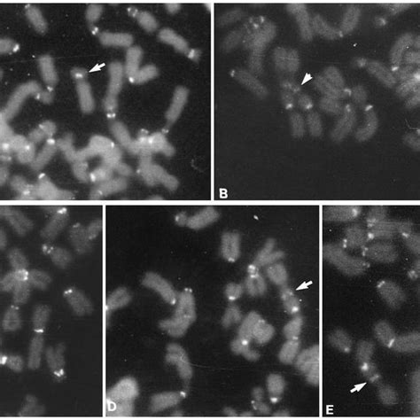A Set Of Several Cells Showing That Minor Satellite Dna In Mouse May Download Scientific