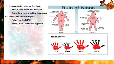Burns Calculation Of Burns Calculation Of Fluid Requirement And Management Pdf