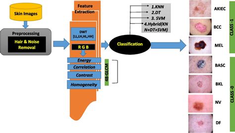 A Systematic Proposed Model Diagram For Skin Disease Classification Download Scientific Diagram