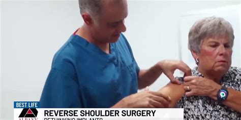 Reverse Shoulder Surgery Rethinking Implants