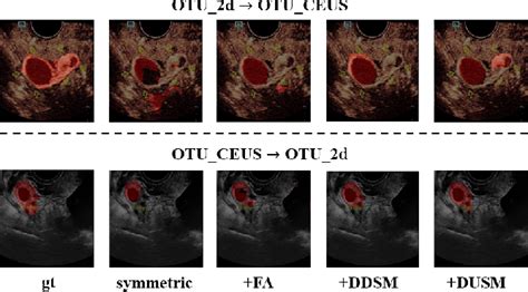 Figure 10 From A Multi Modality Ovarian Tumor Ultrasound Image Dataset